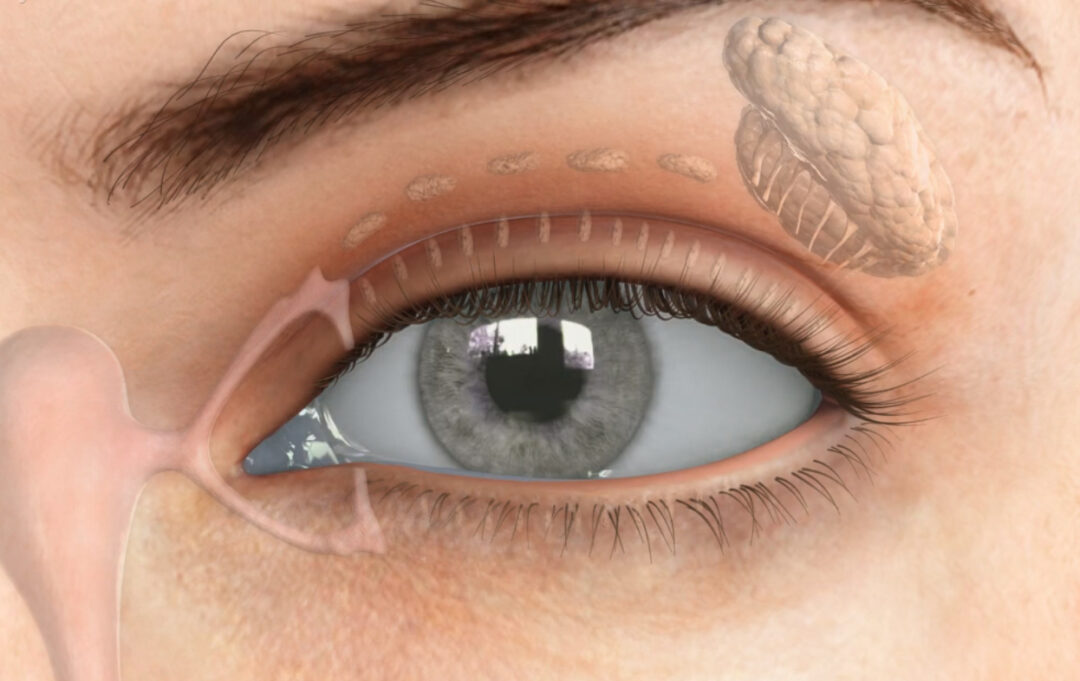 Eye Surgery & Vision Correction Ventura County | DLV Vision