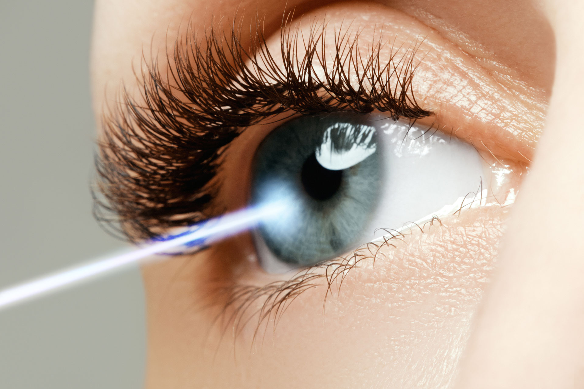 Laser Eye Surgery in Ventura & Los Angeles County | DLV Vision